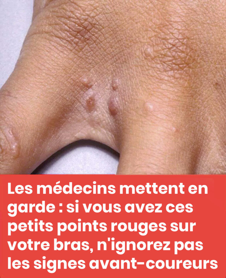 Ne négligez pas ces petites taches rouges sur votre bras – Elles ...